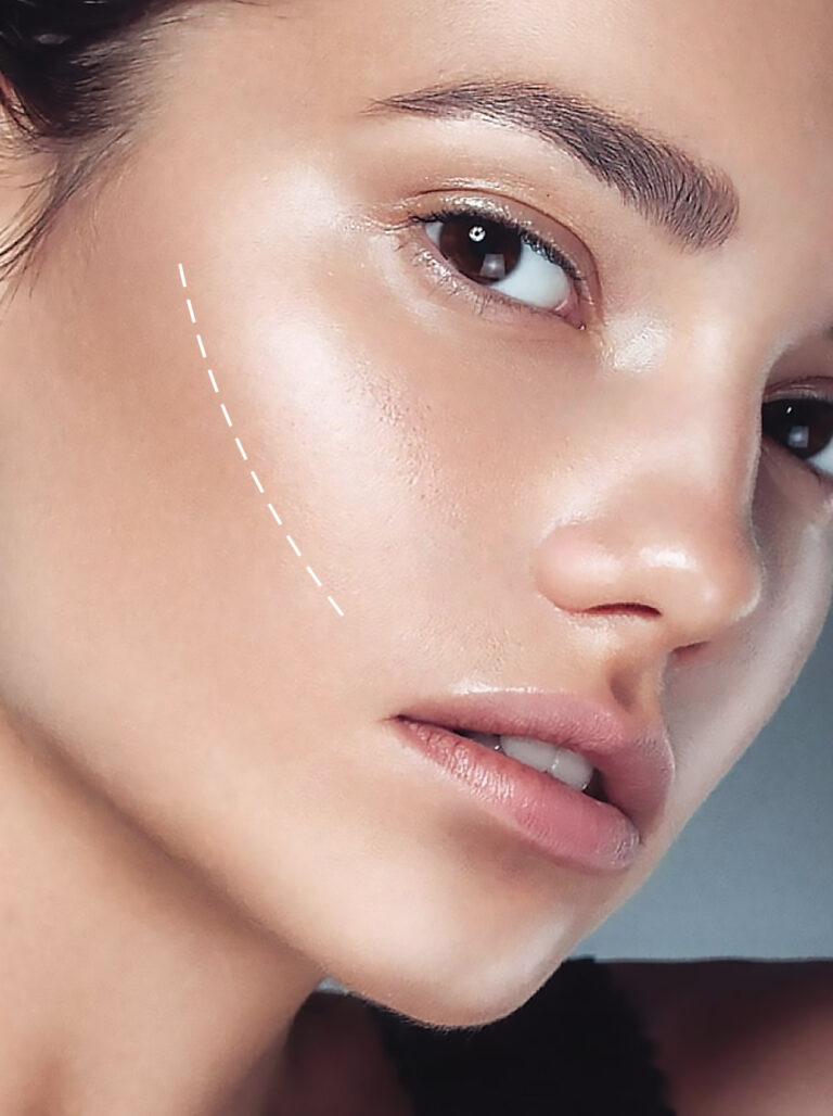 Sunken cheeks | Aesthetically You