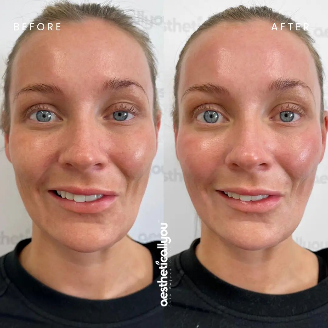 Patient results | Aesthetically You
